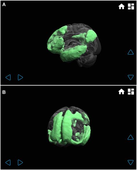 Default Mode Functional Connectivity Network Displayed At Different