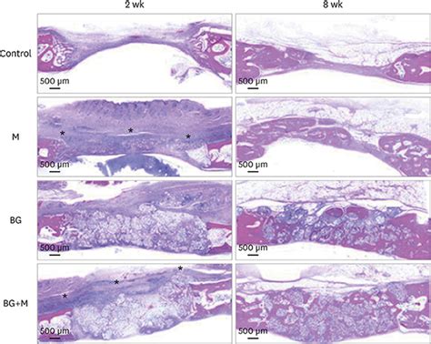 Distinctive Bone Regeneration Of Calvarial Defects Using Biphasic Calcium Phosphate Supplemented