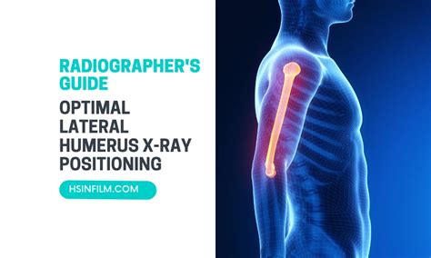 Optimal Lateral Humerus X Rays Positioning The Radiographer S Guide Hsin Film