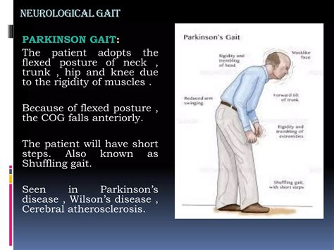 Gait Abnormal Gait By Surya Likhita Ppt