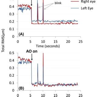 Binocular Vs Monocular Visual Benefit For Visual Acuity A And Download Scientific Diagram
