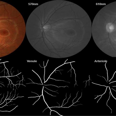 A Sample From A Dual Modal Dataset Download Scientific Diagram