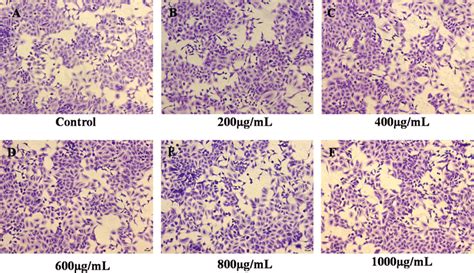 Giemsa Staining For Analyzing Morphology Upon Treatment With PF For Download Scientific