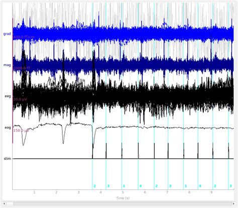 plotting whitened data — mne 1 10 1 documentation