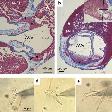 Histological Characteristics Of Av Canal And Av Cell Types Of Rainbow