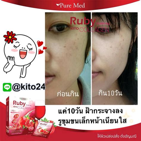 จัดจำหน่ายและรับสมัครตัวแทนแอดไลน์ Ruby24 ม Ruby Collagen