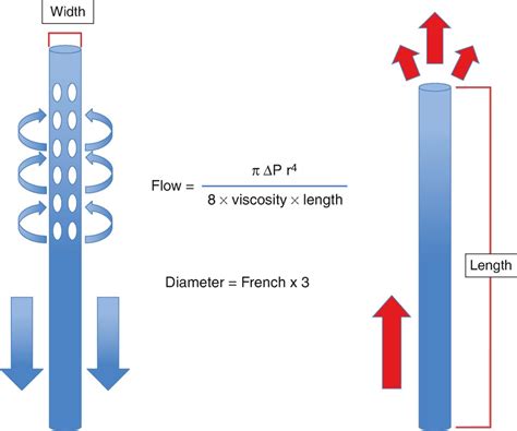 Ecmo Configurations Anesthesia Key