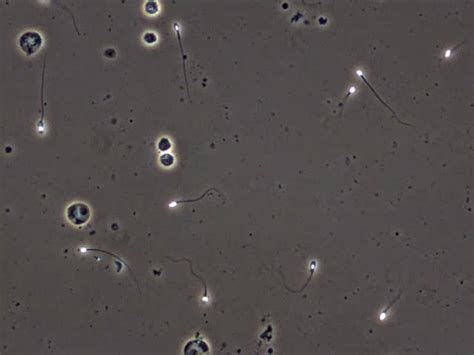 Sperm Detection 2 Object Detection Model By P