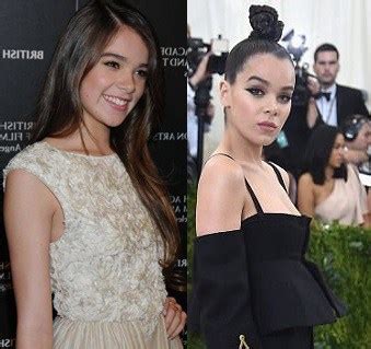 Hailee Steinfeld Plastic Surgery Before And After Photos