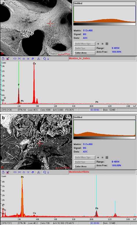 Scanning Electron Micrograph Of Trabecular Bone Left Third Metacarpal Download Scientific