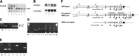 Figure 3 From X Linked Ectodermal Dysplasia And Immunodeficiency Caused By Reversion Mosaicism