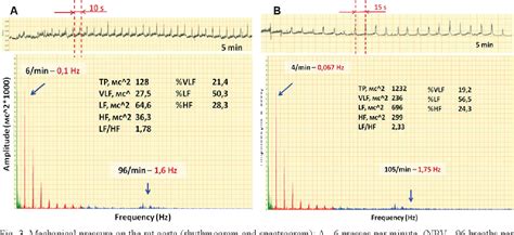 Table 1 From Physiological Interpretation Of Heart Rate Variability Spectral Analysis Data