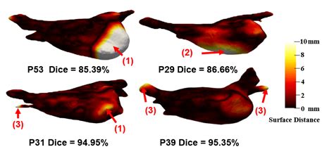 Usformer A Light Neural Network For Left Atrium Segmentation Of 3d Lge Mri Ai In Multimedia