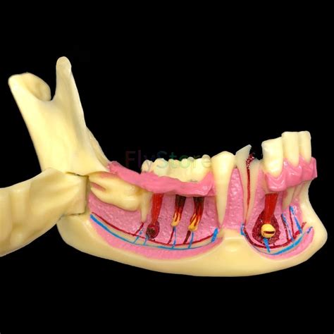 Dental Mandibular Teaching Model Teeth Demonstrati Vicedeal