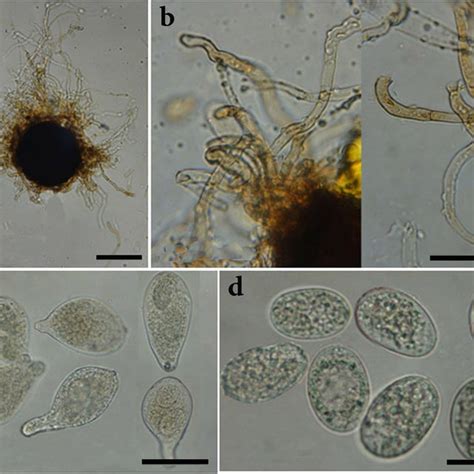 Powdery Mildew Infection On Okra Plants Download Scientific Diagram