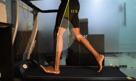Convergent Validity And Reliability Of A New 2d Motion Analysis System For Quantification Of Hip