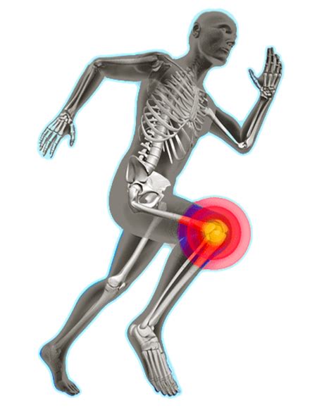 Knee Cartilage Diagnosis And Treatment : Cartilage Transplant Knee