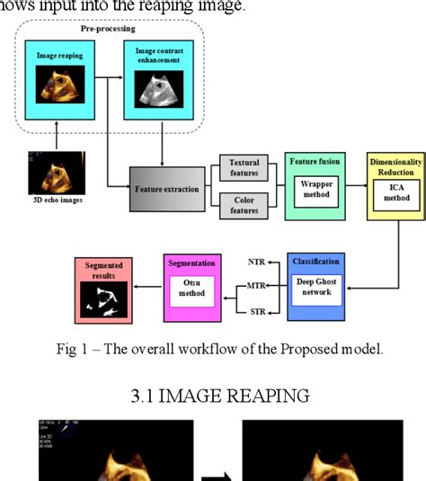 figure 2 from fetal 3d echo classification and segmentation using color