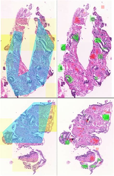 Examples Of Fn Misclassification Low Network Response Top Part Of Download Scientific
