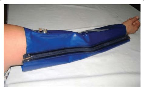 Application Of The Surface Compression Device Source Personal Collection Download