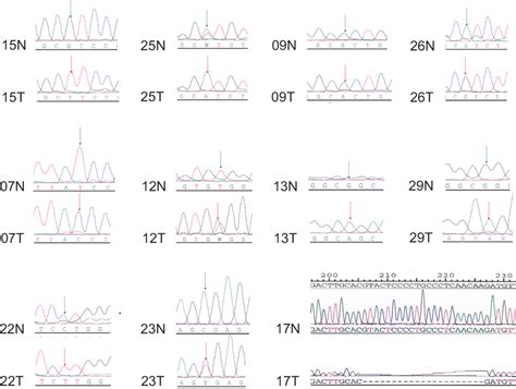 Sequence Analysis Of P53 Cdna A Total Of 11 Samples Have P53