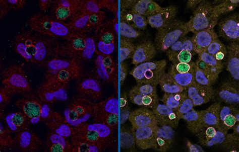 Chlamydia Has A Cloaking Device That Helps The Std Spread Around The