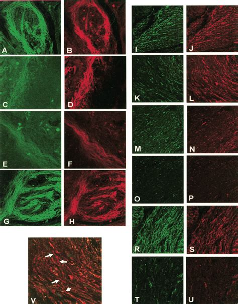 Effect Of Diabetes On NNOS And Cotransmitters In The Penis And Pyloric Download Scientific