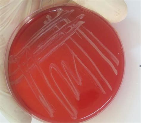 Colonial Morphology Of Brucella On Blood Agar Showing Round