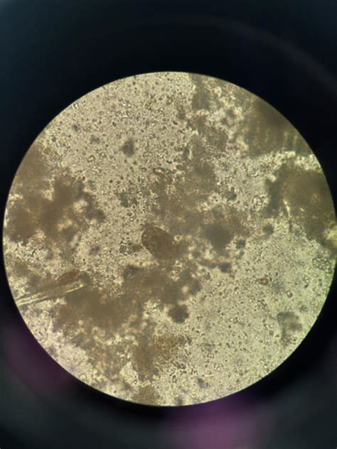 Parasite Object Detection Dataset By Parasite