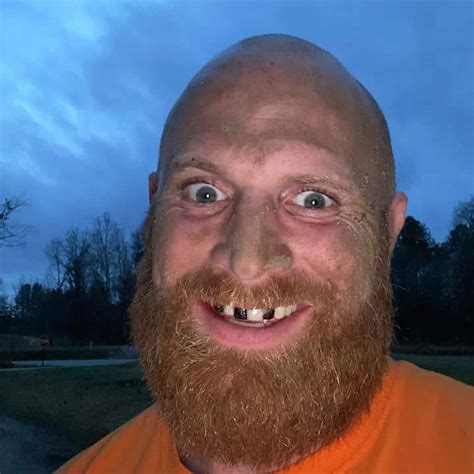 Ginger Billy Anatomy Of A Nurses Brain At Timothy Votaw Blog