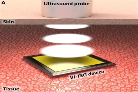 국내 연구진 인체삽입 의료기기 배터리 상시 충전 기술 개발 성공 E4ds 뉴스