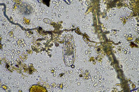 Premium Photo A Microscope Image Of A Plant That Has A Number Of Small Things On It