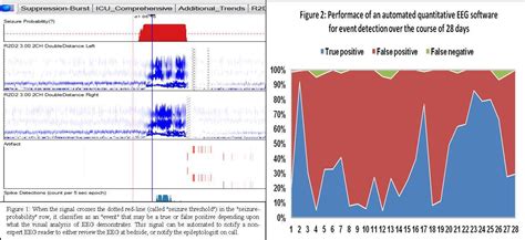 Performance Of Quantitative Eeg Display In Automated Seizure