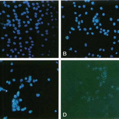 Dna Fragmentation Induced By Snap Dapi Staining Analyzed By Download Scientific Diagram
