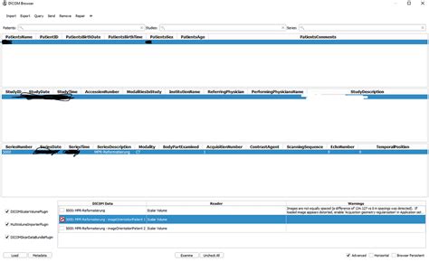 issue importing dicom with overview image support 3d slicer community