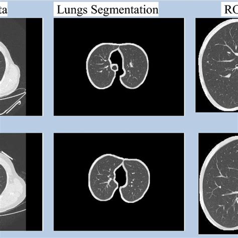 An Overview Of The Preprocessing Stage Download Scientific Diagram