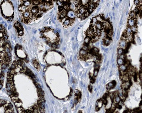 Tissue Tek Genie Rapid True Random Access Ihc Staining
