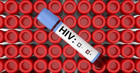 Hiv Testing Confidentiality And Privacy Concerns