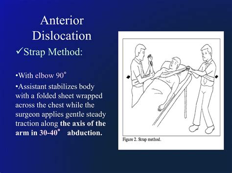 Ppt Shoulder Dislocation Powerpoint Presentation Free Download Id