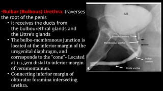 Anterior Urethrogram Retrograde Urethrogram Pptx