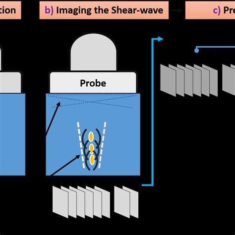 Schematic Of Shear Wave Elasticity Imaging A Shear Wave Generation