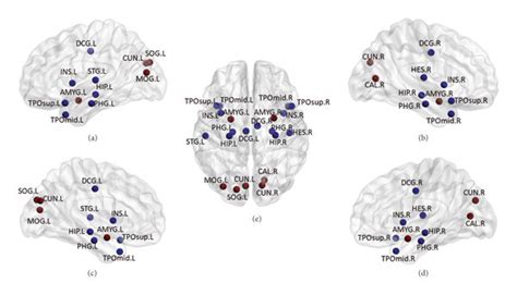 Brain Regions With Statistically Significant Differences In Node