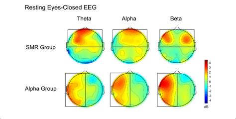 The Difference Of Eeg Power Between Pre Test And Post Test Of The