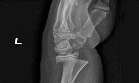 Pediatric Emergency Care