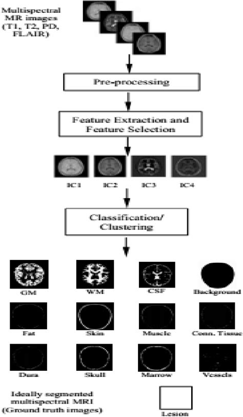 Figure 1 From Independent Component Analysis In Automated Segmentation