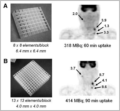 Dual Modality Imaging Combining Anatomy And Function Journal Of Nuclear Medicine