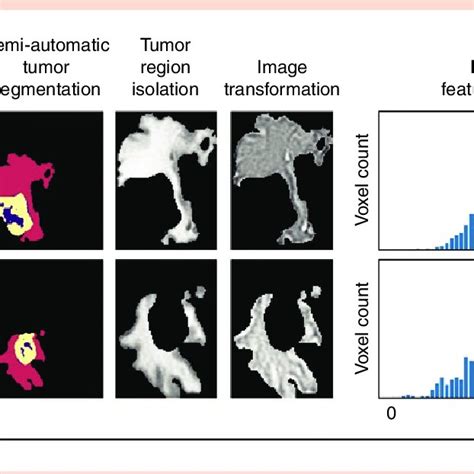 Diagram Of Radiomic Feature Extraction From Mri Feature Extraction