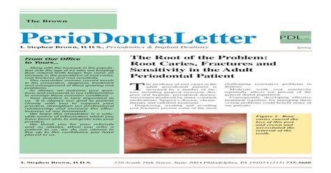 Pdf The Root Of The Problem Root Caries Fractures And Dokumentips