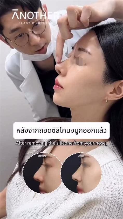 วิเคราะห์ใบหน้าน้อง Anna สมาชิก วง Meovv🐱 Visual ไอดอลที่มาพร้อมใบหน้า