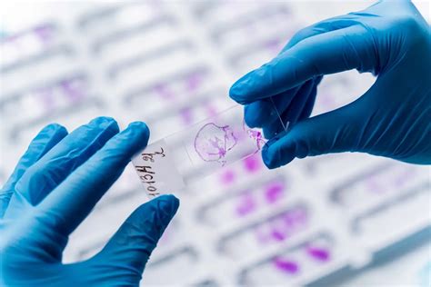 Ffpe Tissue Samples Precision For Medicine